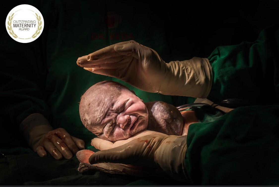 3 dicas sobre fotografia de parto - Outstanding Award Magazine